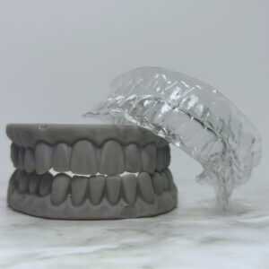 How to Get a Retainer Using Your Own Molds or Models - SportingSmiles ...
