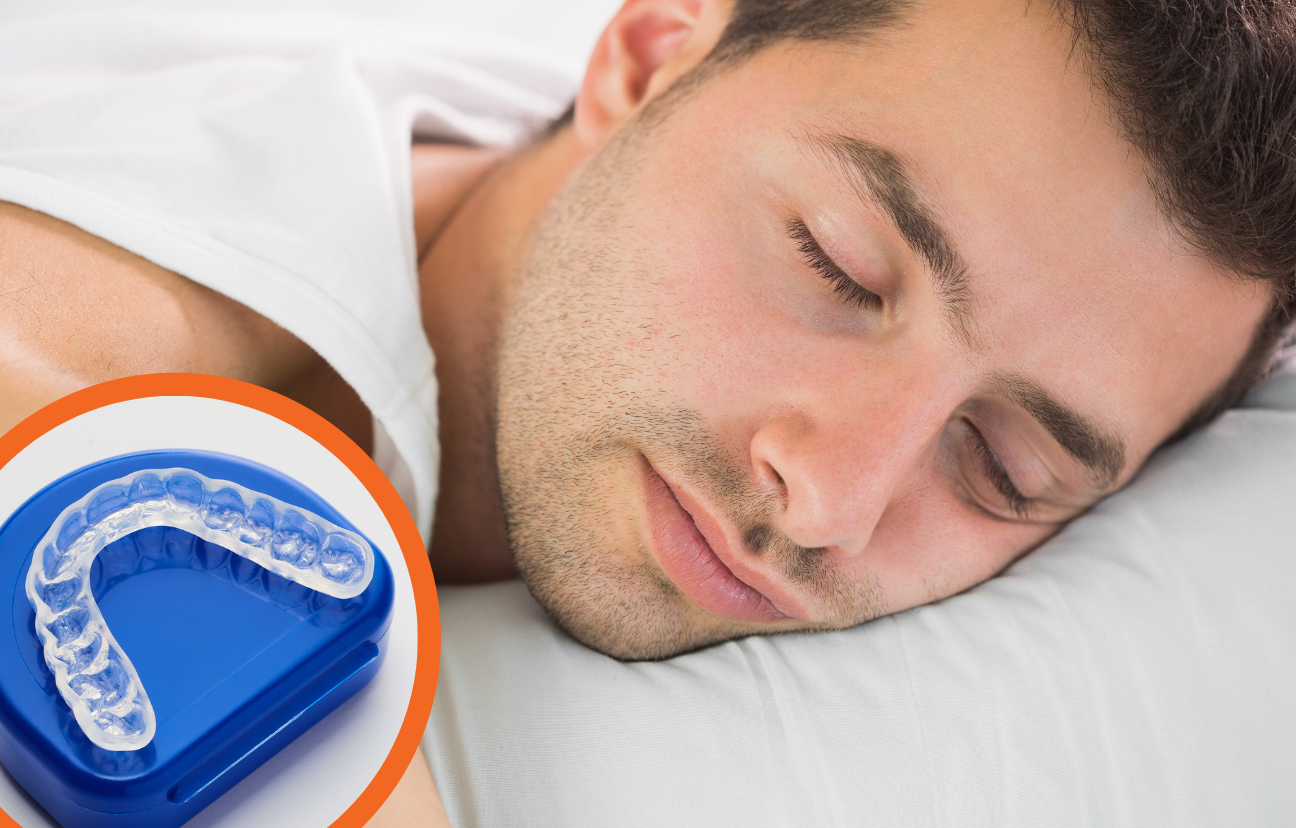 Custom Night Guards | Mouth Guards For Teeth Grinding