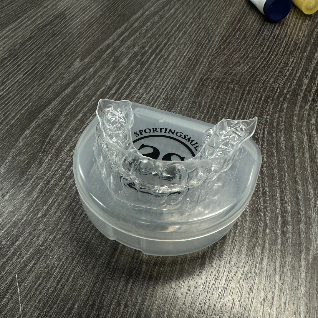 Broken Permanent Retainer? Here's What You Can Do. - SportingSmiles Dental