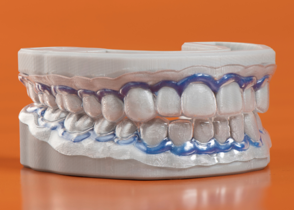 Buy a Custom Perio Tray Set | SportingSmiles