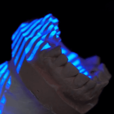 All About SportingSmiles dental manufacture